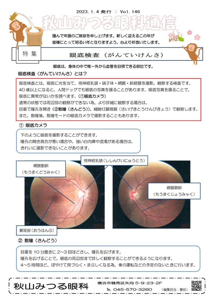 眼科通信Vlo.146【眼底検査】 | 秋山みつる眼科｜横浜市鶴見区の眼科（矢向駅徒歩5分）